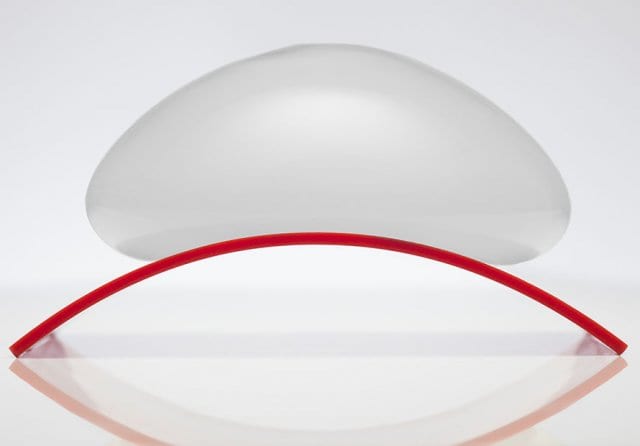 What’s Your IDEAL Implant? – Aristocrat Plastic Surgery