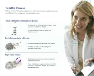 Non-surgical Cellulite Removal with Cellfina™ – Aristocrat Plastic Surgery